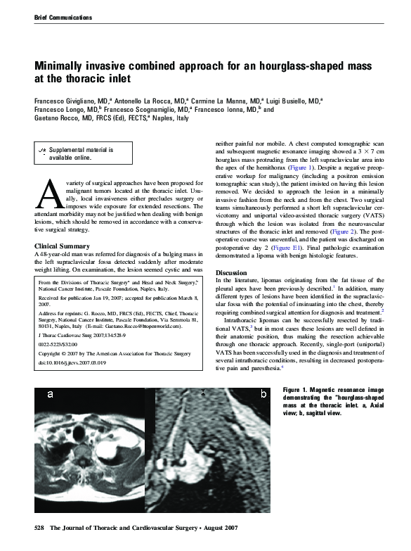(PDF) Minimally invasive combined approach for an hourglass-shaped mass ...