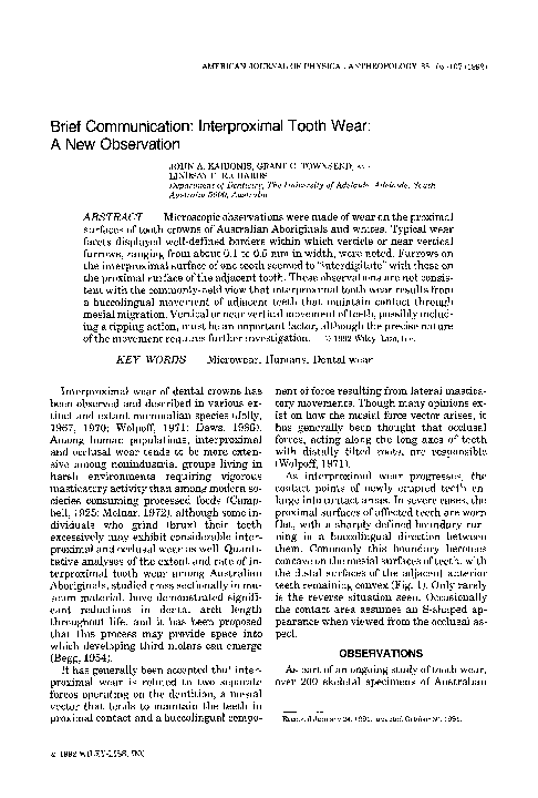 (PDF) Interproximal tooth wear: A new observation
