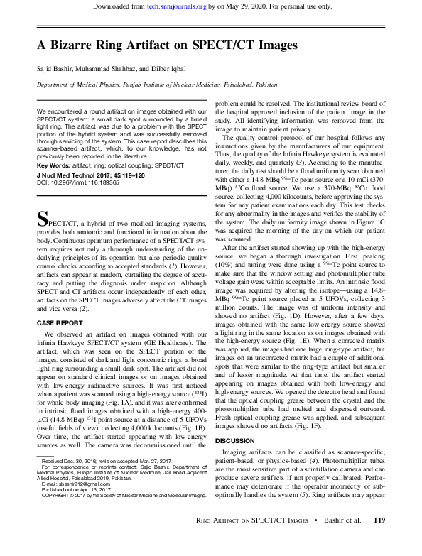 (PDF) A Bizarre Ring Artifact on SPECT/CT Hybrid System | dilber iqbal ...