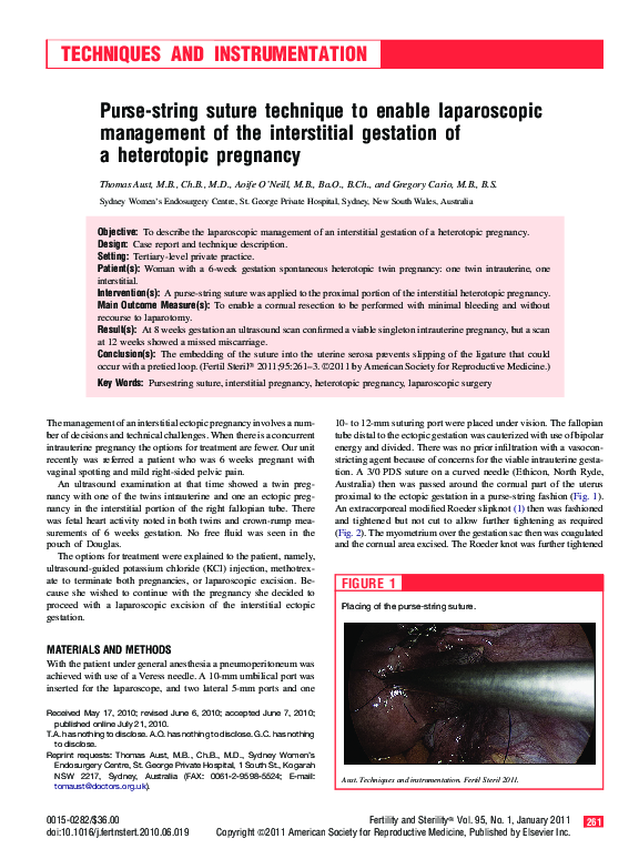 Pdf Purse String Suture Technique To Enable Laparoscopic Management Of The Interstitial