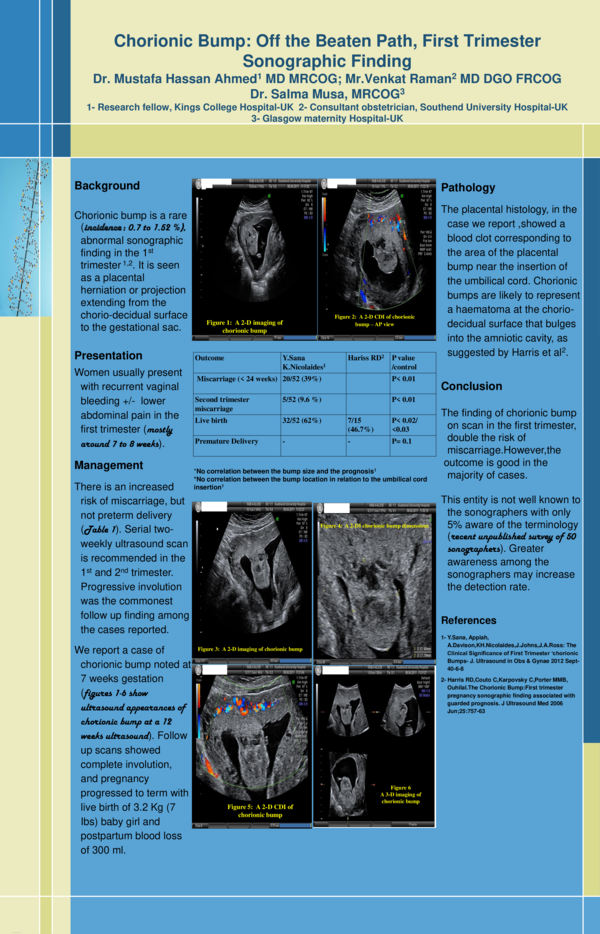 (PDF) Chorionic bump: off the beaten path first trimester sonographic ...