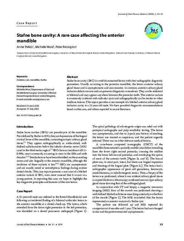 (PDF) Stafne bone cavity: A rare case affecting the anterior mandible