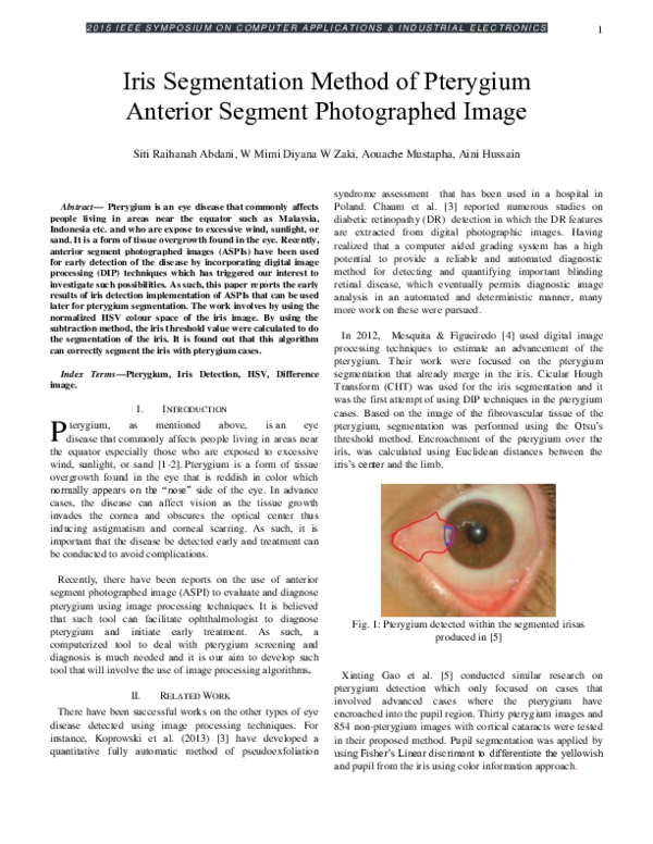 (PDF) Iris segmentation method of pterygium anterior segment photographed image