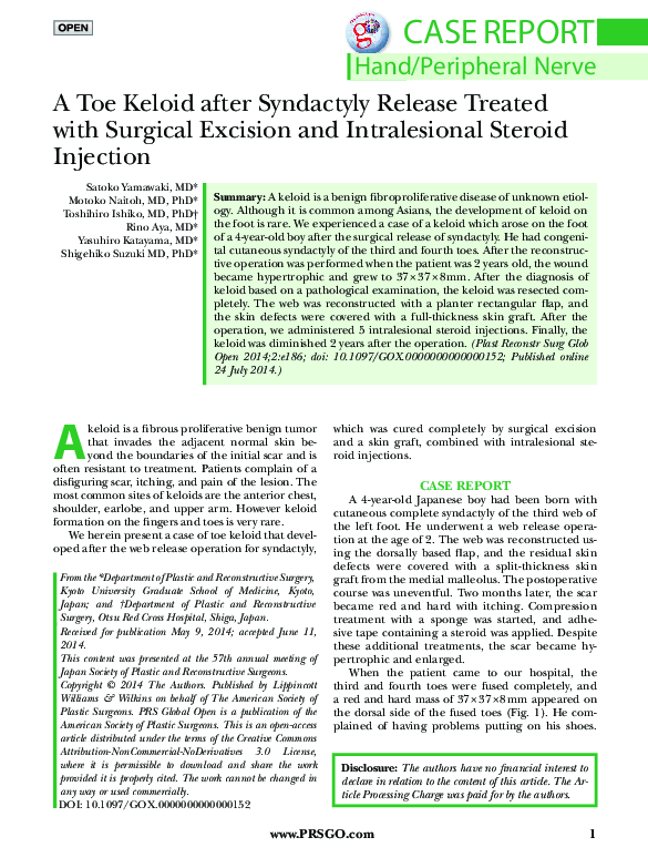 (PDF) A toe keloid after syndactyly release treated with surgical ...