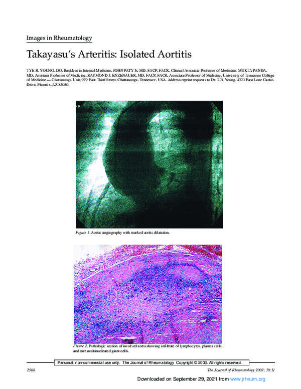 (PDF) Takayasu's arteritis: isolated aortitis | Mukta Panda - Academia.edu