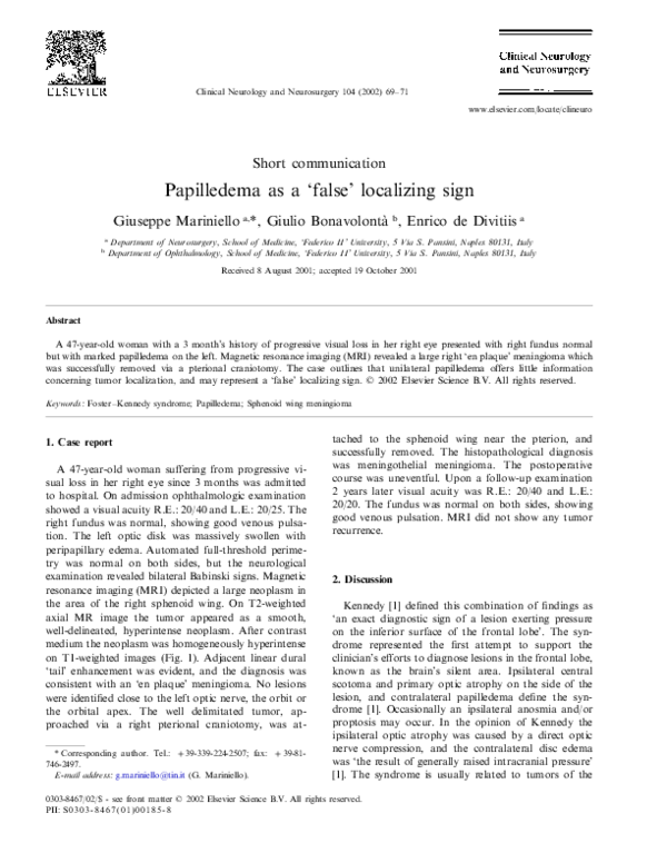 (PDF) Papilledema as a ‘false’ localizing sign