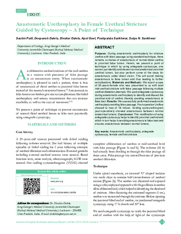 (PDF) Anastomotic Urethroplasty in Female Urethral Stricture Guided by ...
