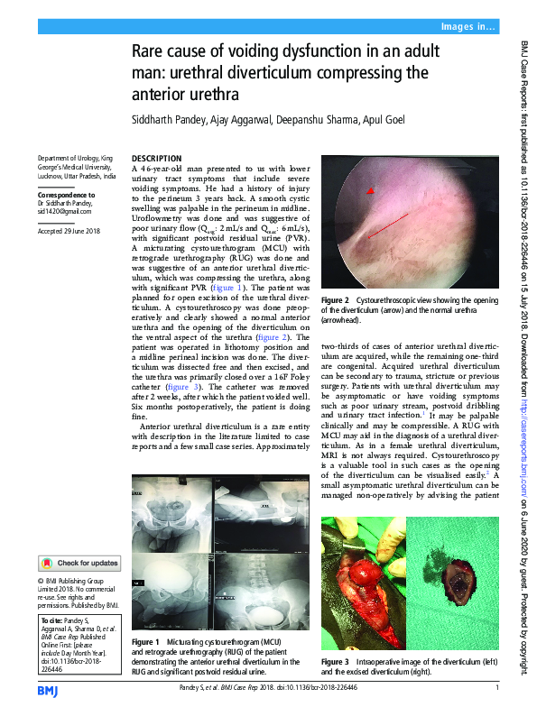 (PDF) Rare cause of voiding dysfunction in an adult man: urethral ...