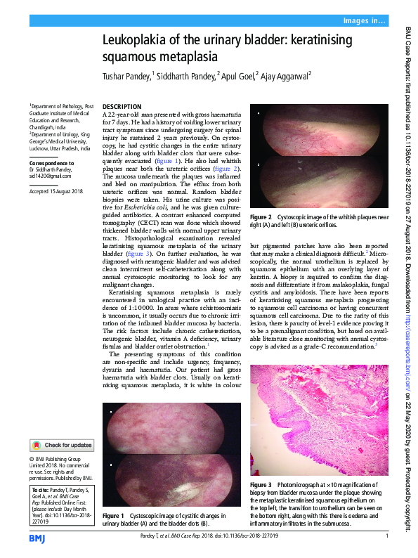 (PDF) Leukoplakia of the urinary bladder: keratinising squamous metaplasia