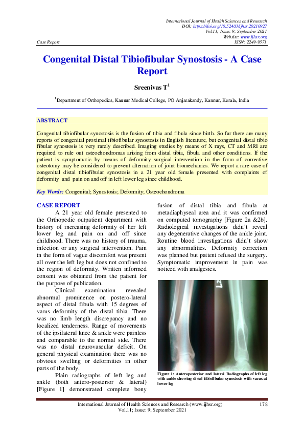 (PDF) Congenital Distal Tibiofibular Synostosis -A Case Report