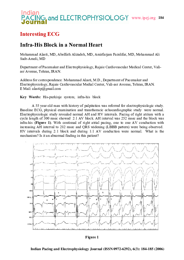 (PDF) Infra-His Block in a Normal Heart