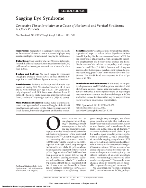 (PDF) Sagging eye syndrome: connective tissue involution as a cause of ...