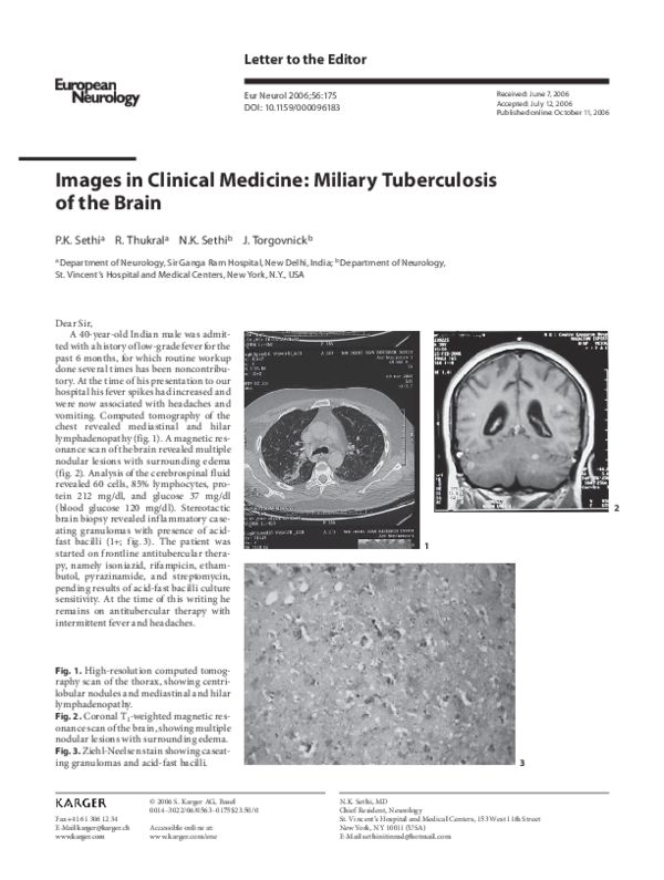 (PDF) Images in Clinical Medicine: Miliary Tuberculosis of the Brain ...