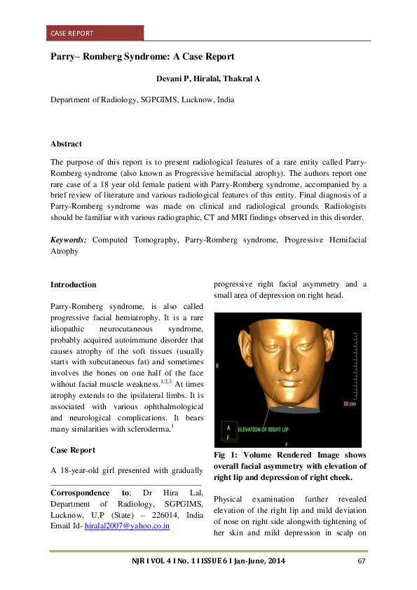 (PDF) Parry– Romberg Syndrome: A Case Report