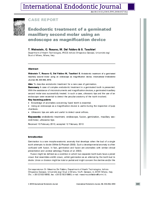 (PDF) Endodontic treatment of a geminated maxillary second molar using ...