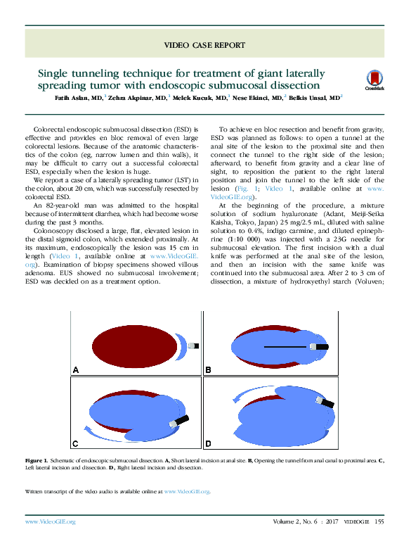 (PDF) Single tunneling technique for treatment of giant laterally spreading tumor with ...