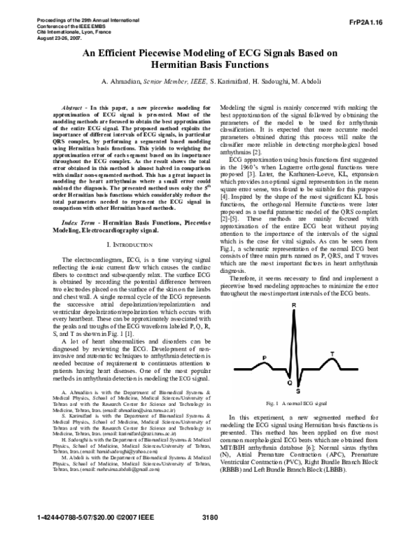 Pdf An Efficient Piecewise Modeling Of Ecg Signals Based On Critical