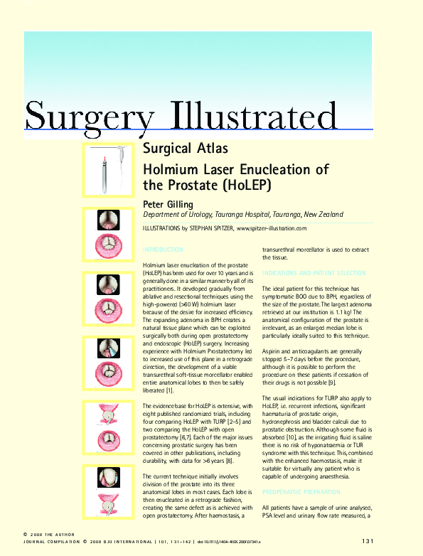 (PDF) Holmium Laser Enucleation of the Prostate (HoLEP)