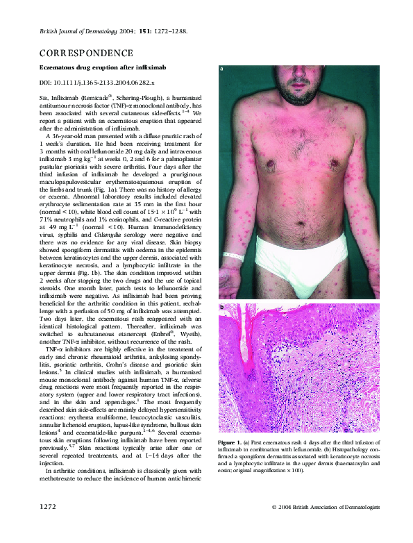 (PDF) Eczematous drug eruption after infliximab