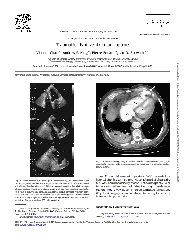 (PDF) Traumatic right ventricular rupture | Ian Burwash - Academia.edu