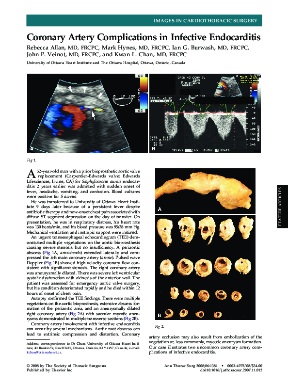 (PDF) Coronary Artery Complications in Infective Endocarditis
