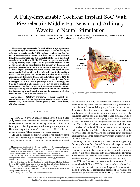 (PDF) A Fully-Implantable Cochlear Implant SoC With Piezoelectric ...