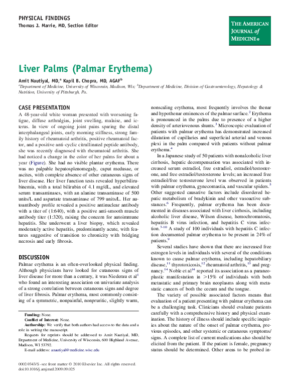 (PDF) Liver Palms (Palmar Erythema)