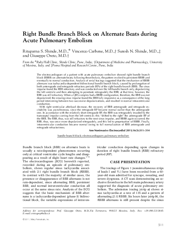 (PDF) Right bundle branch block on alternate beats during acute ...