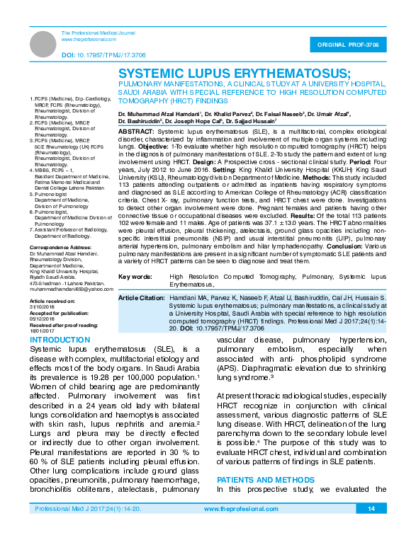 (PDF) Systemic Lupus Erythematosus