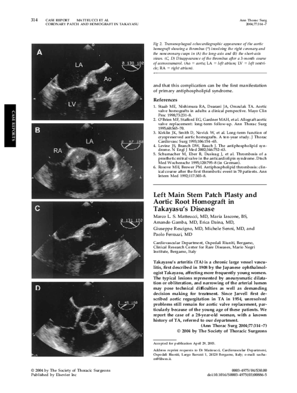 (PDF) Left main stem patch plasty and aortic root homograft in Takayasu ...