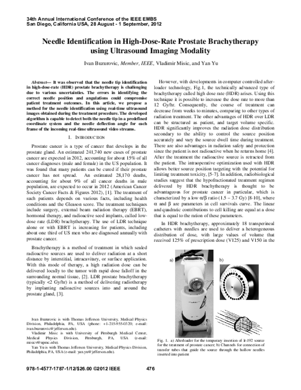 (PDF) Needle identification in high-dose-rate prostate brachytherapy ...