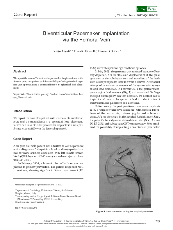 (PDF) Biventricular Pacemaker Implantation via the Femoral Vein