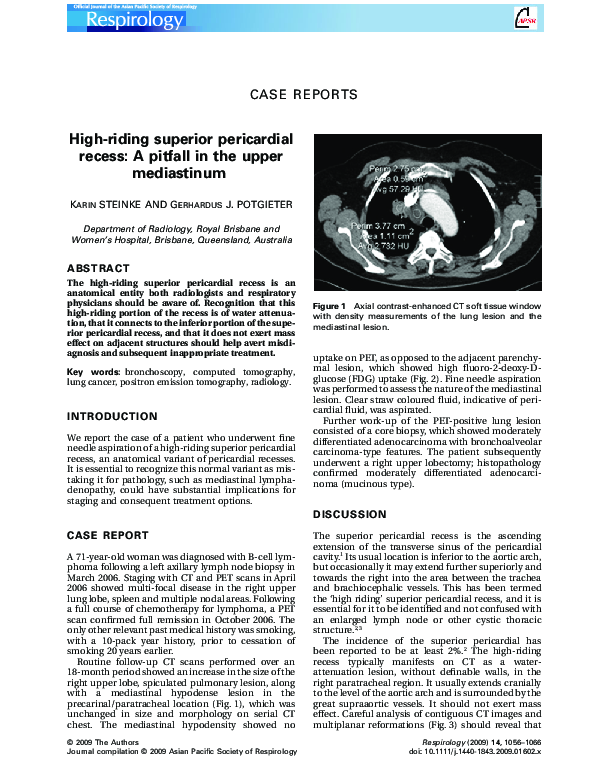 (PDF) High-riding superior pericardial recess: A pitfall in the upper ...