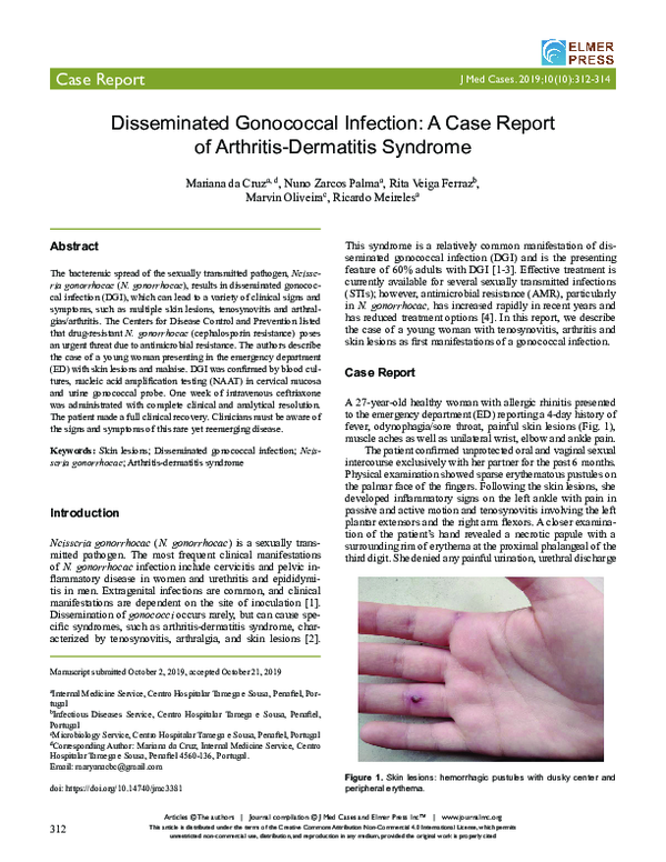 (PDF) Disseminated Gonococcal Infection: A Case Report of Arthritis ...