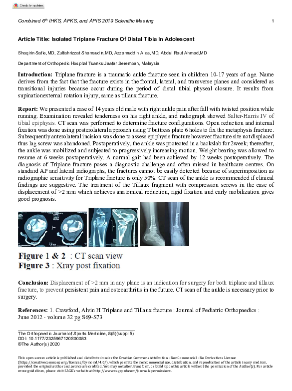 (PDF) Isolated Triplane Fracture Of Distal Tibia In Adolescent