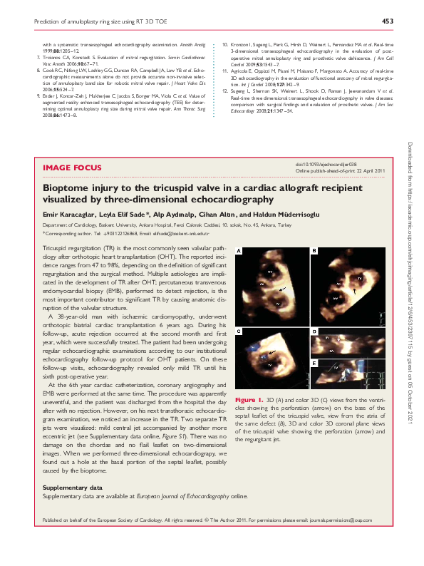 (PDF) Bioptome injury to the tricuspid valve in a cardiac allograft ...