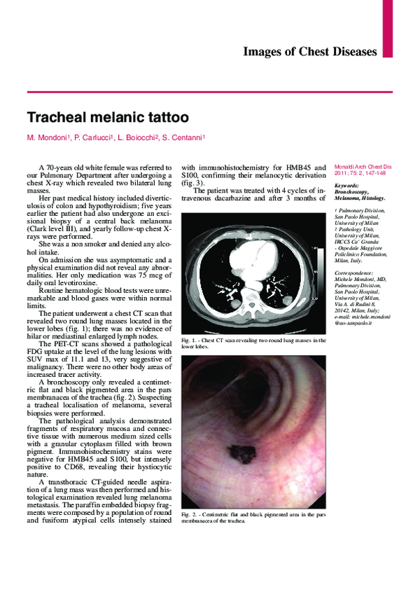 (PDF) Tracheal melanic tattoo