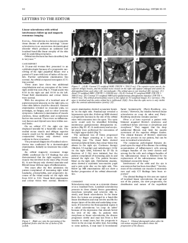 (PDF) Orbital Surgery. A Conceptual Approach