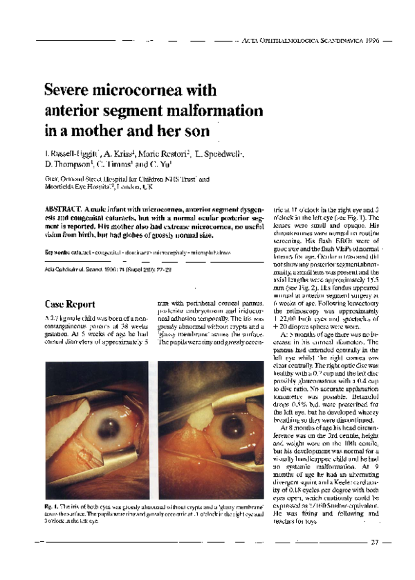 (PDF) Severe microcornea with anterior segment malformation in a mother ...