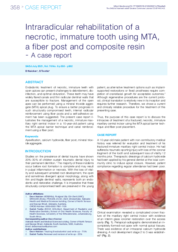 (PDF) Intraradicular rehabilitation of a necrotic, immature tooth using ...