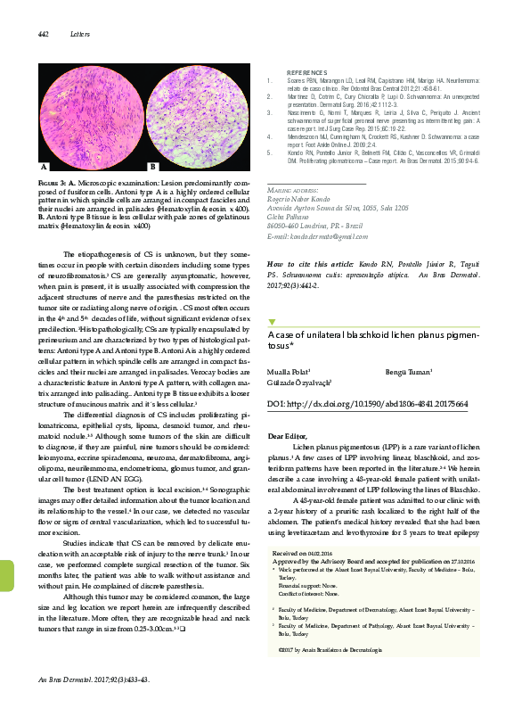 (PDF) A case of unilateral blaschkoid lichen planus pigmentosus