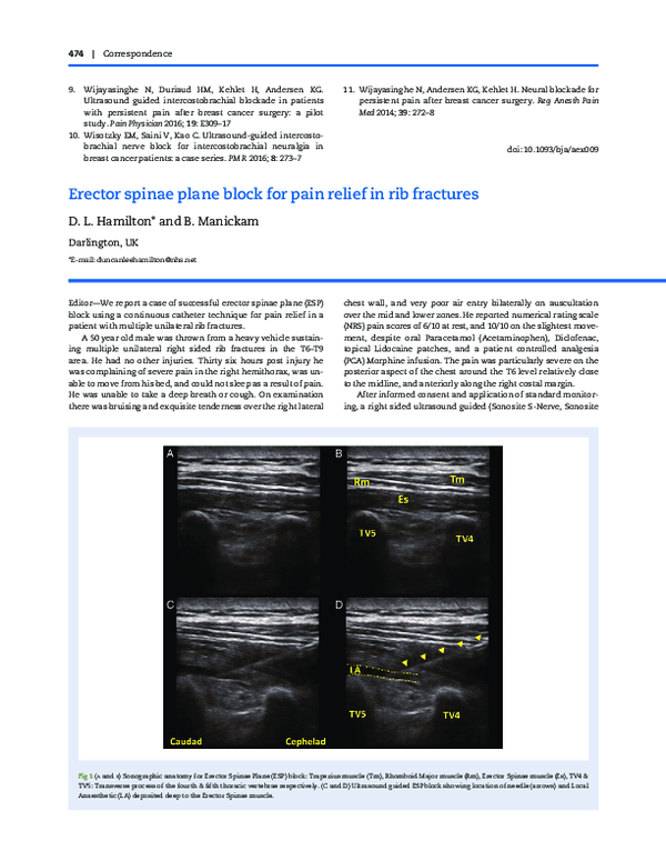 (PDF) Erector spinae plane block for pain relief in rib fractures