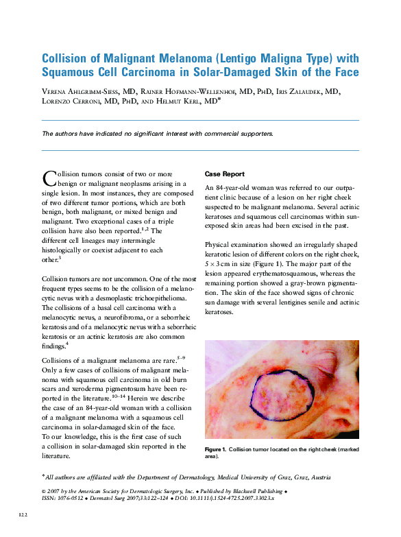 (PDF) Collision of Malignant Melanoma (Lentigo Maligna Type) with ...