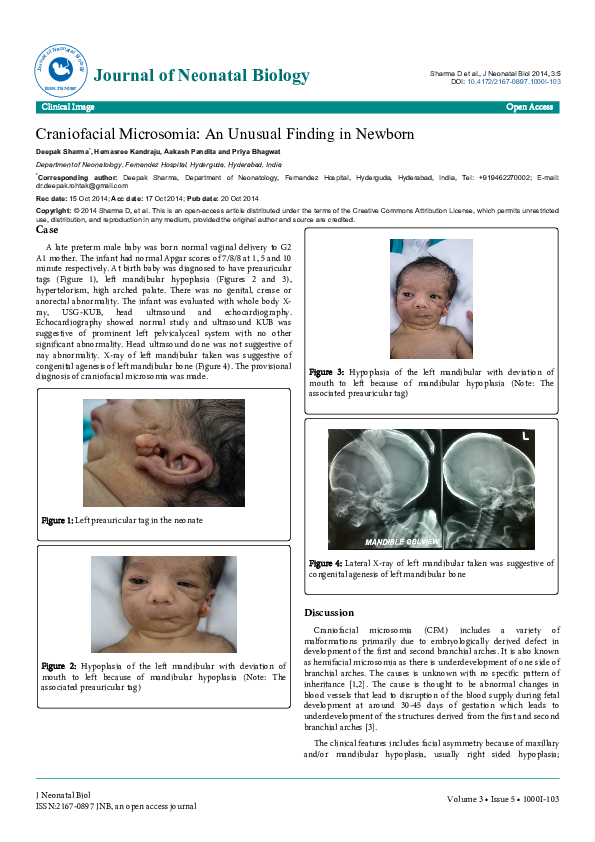 (PDF) Craniofacial Microsomia: An Unusual Finding in Newborn
