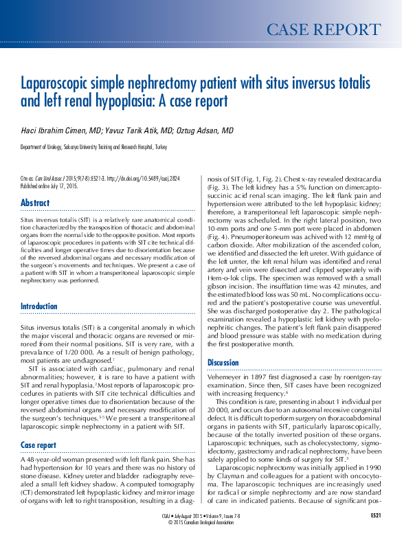 (PDF) Laparoscopic simple nephrectomy patient wıth situs inversus totalis and left renal ...
