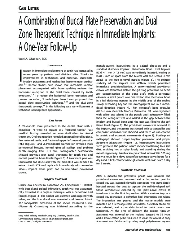 (PDF) A Combination of Buccal Plate Preservation and Dual Zone ...