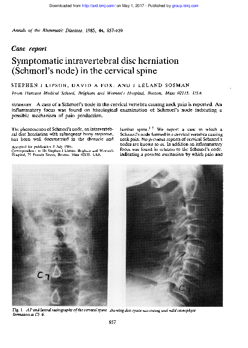 (PDF) Symptomatic intravertebral disc herniation (Schmorl's node) in ...