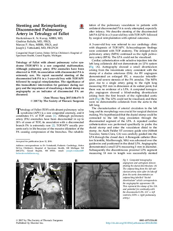 (PDF) Stenting and Reimplanting Disconnected Pulmonary Artery in ...