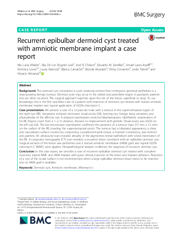 (PDF) Recurrent epibulbar dermoid cyst treated with amniotic membrane ...