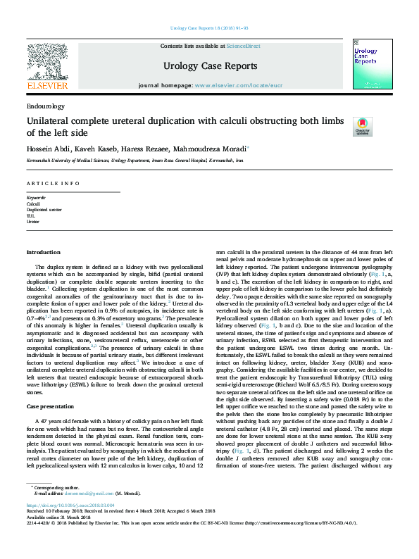 (PDF) Unilateral complete ureteral duplication with calculi obstructing both limbs of the left side